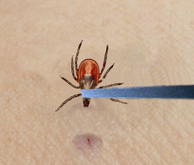 Cold, snowy winter linked to spike in area tick bites - The Suffolk Times
